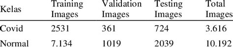 Amount Of Data Before Augmentation And Undersampling Download Scientific Diagram