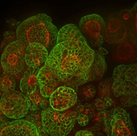 Colin Paul On Linkedin Cancerresearch Tumorbiology 3dcancerculture