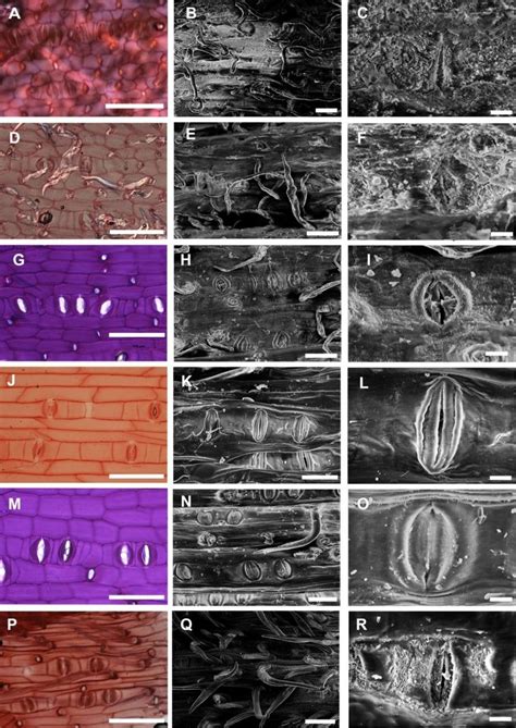 Lm And Sem Of Cassytha Stem Surface A C Stomata Of C Aurea Var Download Scientific Diagram