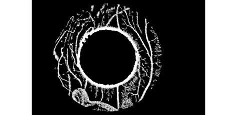 Image Processing How To Get The Length Of Vessels From The Photo In Matlab Stack Overflow