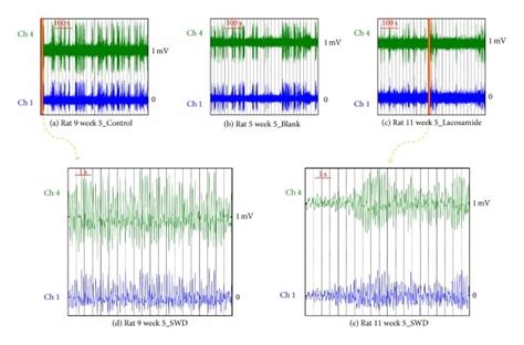 Example Of EEG Recording From Rats Belonging To Group Control A Download Scientific