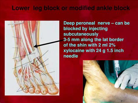 Ppt Regional Anesthesia For The Lower Limbs Dr Prakash Ambardekar