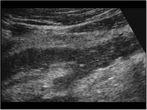 Peripheral Vessels 102 Peripheral Veins Case 1025 Venous System