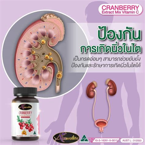 🔮อาการนิ่วในไต รักษาได้ ไม่ต้องผ่า 😫ปวดท้อง ปวดหลัง อาจเป็นสัญญาณบ่งชี้