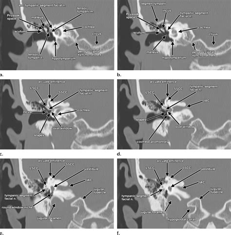 Figure 2 From Interactive Web Based Learning Module On Ct Of The