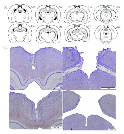 Extent And Appearance Of The Dysgranular Retrosplenial Cortex Lesions Download Scientific