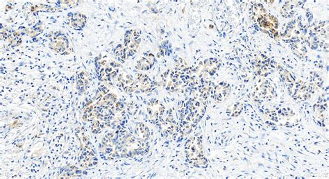 Lipocalin 2 Ngal Antibody 82841 1 Rr Proteintech