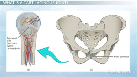 Synchondrosis Key Examples And Functions