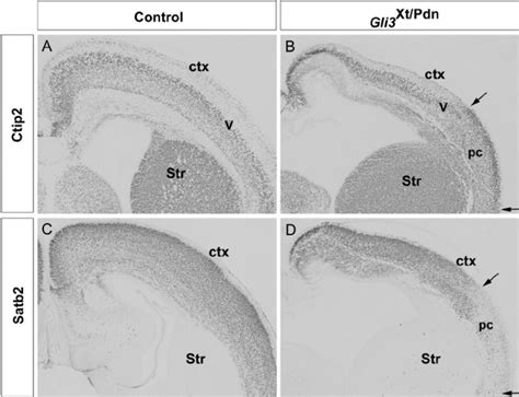 Corticospinal Motor Neurons And Callosal Neurons Are Formed In Gli3 Xt