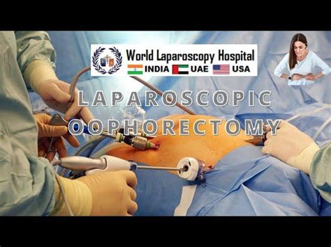 Laparoscopic Salpingo Oophorectomy For Recurrent Endometrioma And… Dr R K Mishra