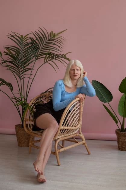 Free Photo Full Shot Woman With Albinism Posing In Studio