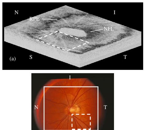 A 25 Mb 3 Dimensional Reconstruction Of The Retina From The Images