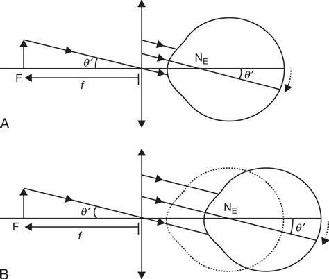 Relative Distance Magnification Decreasing The Viewing Distance Ento Key