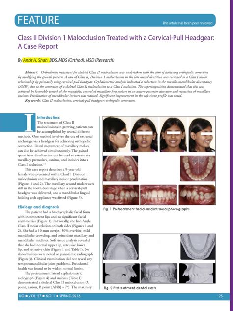 Feature Class Ii Division 1 Malocclusion Treated With A Cervical Pull Headgear A Case Report