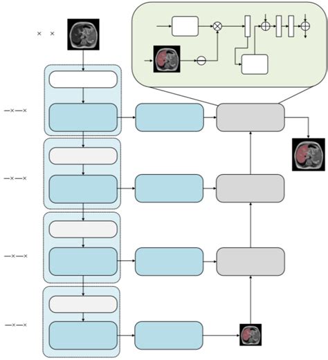 [논문 리뷰] A Reverse Mamba Attention Network For Pathological Liver Segmentation