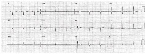Axis The Science Of Direction Worksheet Medicine Digital Learning