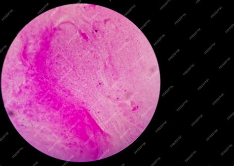 Coccus Bacteria 400x