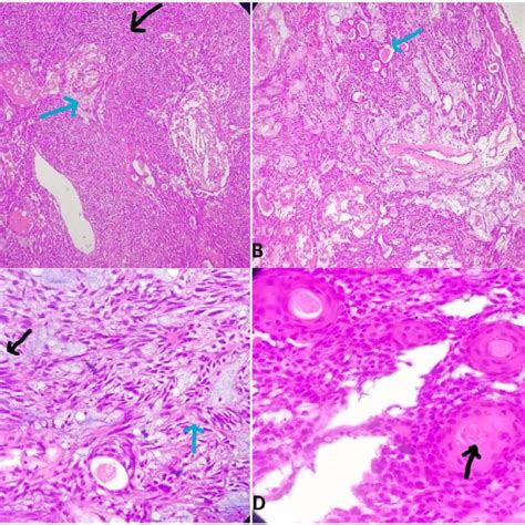 Histology Section Using Hematoxylin And Eosin Staining A Cellular Download Scientific