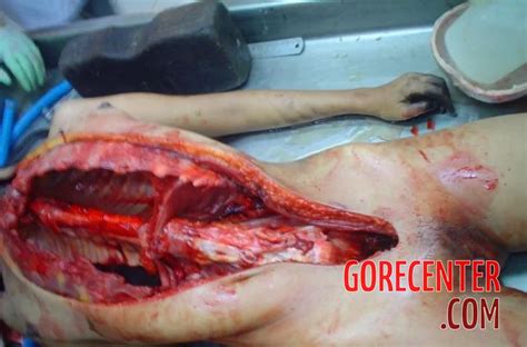 MIX Naked And Dead Women On The Dissection Table GoreCenter