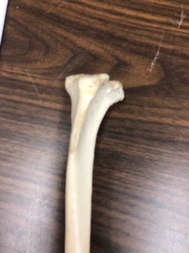 Tibia Flashcards Quizlet