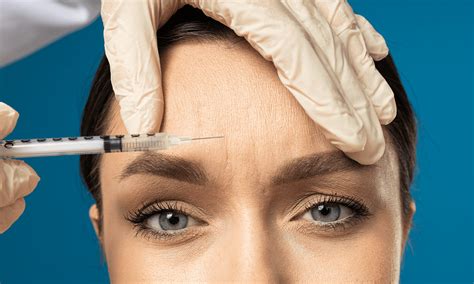Lip Flip Botox Everything You Need To Know Lip Flip Botox Everything You Need To Know