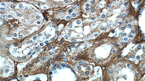 Fibrinogen Beta Chain Rabbit Polyclonal Antibody