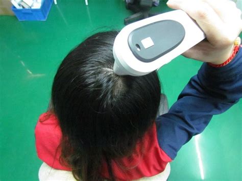 2022magic Mirror Skin Analyzer Hair Scalp Camera With Usb Scalp Detector