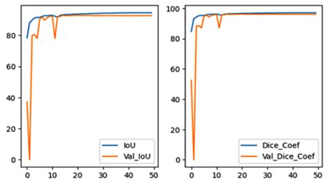 lung image segmentation with improved u net v net and seg net