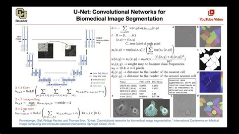 U Net Qanda Lecture 26 Part 3 Applied Deep Learning