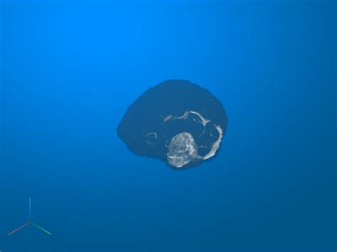 Surface
