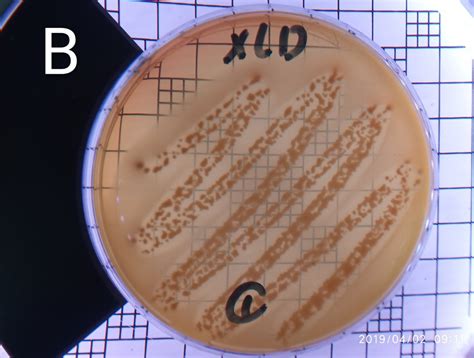 Issues Related To Salmonella Detection Methods Researchgate Issues Related To Salmonella Detection Methods Researchgate