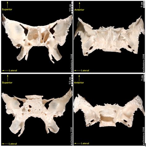 Sphenoid Diagram Quizlet