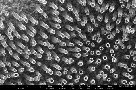 Whats The Difference Between Sem And Tem Nanoscience Instruments