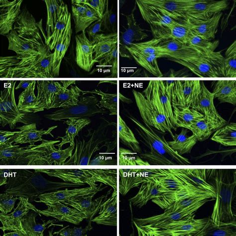 Effect Of Sex Hormones And Or NE Treatment On NRVM Sarcomeric Download Scientific Diagram