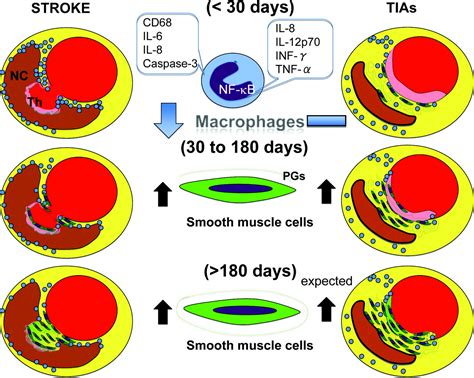 Carotid Plaque Stabilization And Progression After Stroke Or Tia