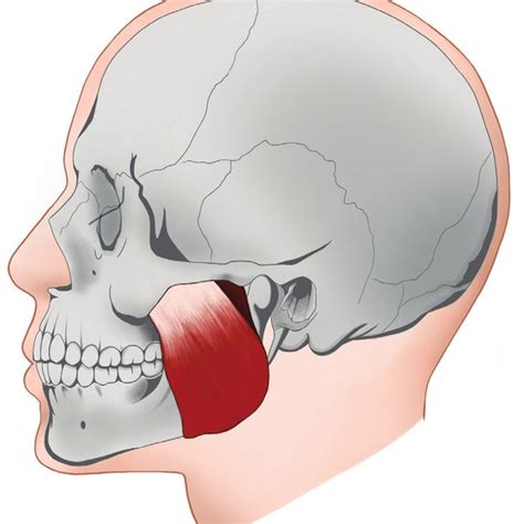 Masseter Muscle Recommended Injection Sites Download Scientific Diagram