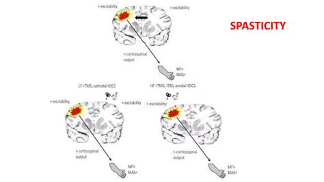 Transcranial Magnetic Stimulation Versus Transcranial Direct Current Stimulation As