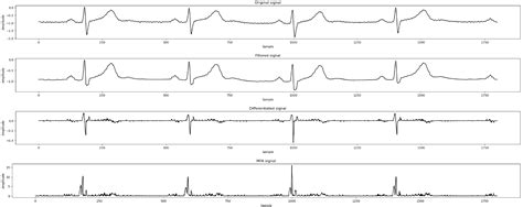 Filter Design Multiscale Mathematical Morphology Filtering On Python Signal Processing Stack