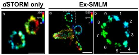 molecular resolution imaging by post labeling expansion single molecule