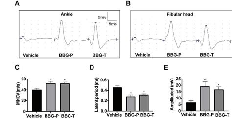 P2x7 Receptor Antagonists Modulate Experimental Autoimmune Neuritis Via Regulation Of Nlrp3