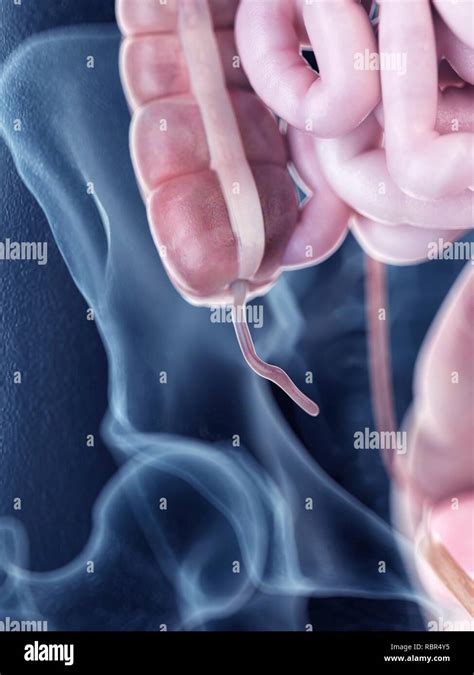 Appendix Anatomy Hi Res Stock Photography And Images Alamy