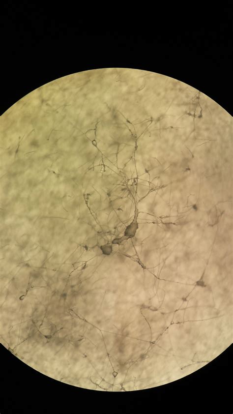 Pythium Ultimum Under A Microscope Looks Almost Like A Neuron Rpics