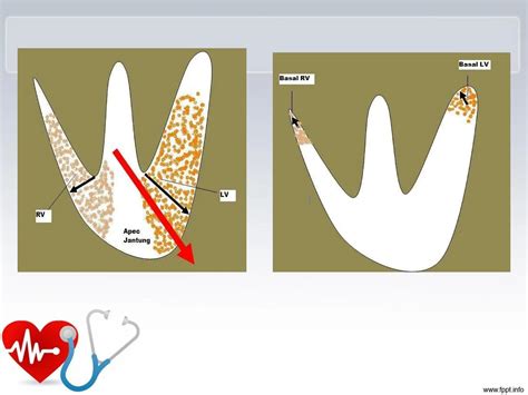 Slide Pelatihan Ekg Strip Untuk Mahasiswa Ppt