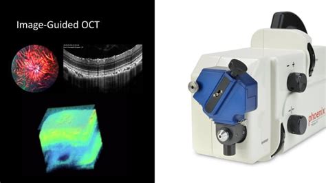 Optimizing Image Guided Laser Induced Choroidal Neovascularization In Mice Pdf