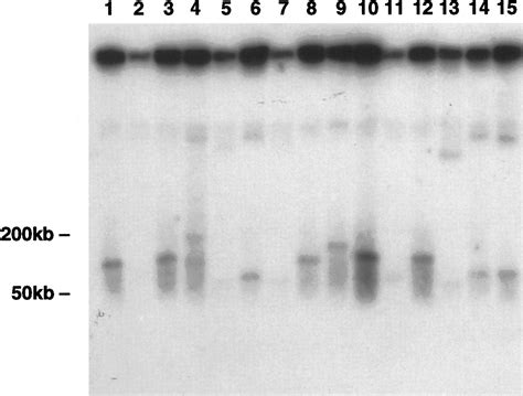Rescue Of Targeted Regions Of Mammalian Chromosomes By In Vivo Recombination In Yeast