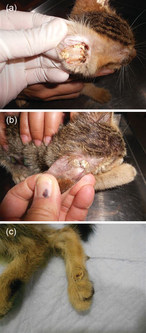 Clinical Pictures Of Favic Scutula Found In Case 2 A Case 3 B And Download Scientific
