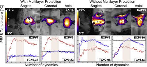 Top Row Two Examples Of Ex Vivo Experiments In Which HIFU Ablation Was Download Scientific