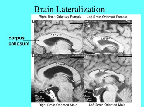 Ppt Sex Differentiation Powerpoint Presentation Free Download Id746086