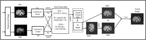 fusion outline using 1d‐dwt for the mmdwt methodology download