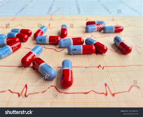 ecg ventricular pacing rhythm artificial pacemaker foto stock